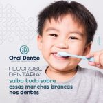 Fluorose dentária: saiba tudo sobre essas manchas brancas nos dentes ...